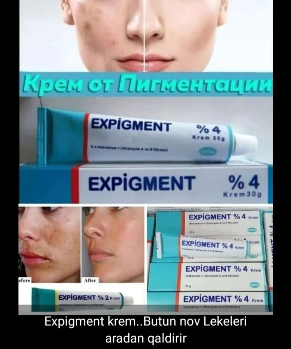 Sızanaq, hamiləlik, lazerden dusen lekeler yaşlanma,: 18 AZN Üz ...