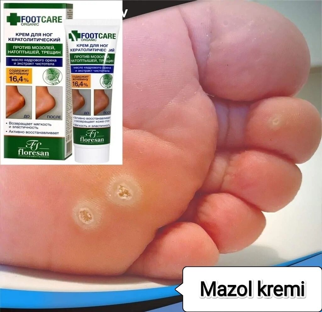 Mazol ücun krem elde ayagda yaranan: 15 AZN Bədənə qulluq | Bakı | 87322153 ᐈ lalafo.az